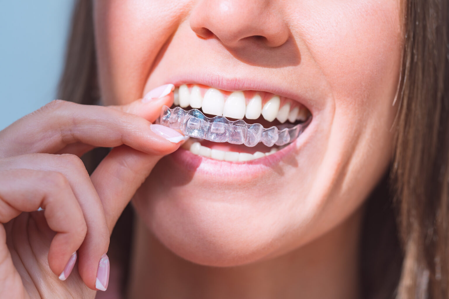 What to Do If You Lose or Break Your Retainer - Silverlake Orthodontics
